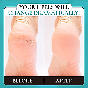 aogi Foot rasp Pedicure Foot File - Removes Damaged and Hard Skin, Avoids Callus Buildup – Gentle, Fine File for at-Home Professional Treatment (Black, Waterproof, Comes with Original Pouch)