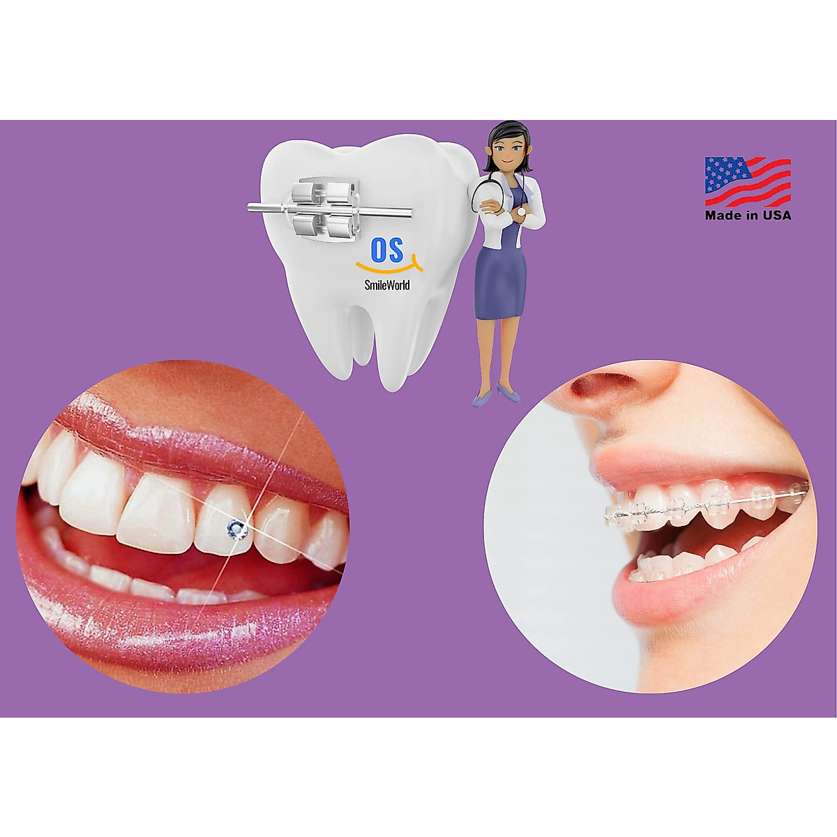 SmileWorld Blue Gel 36 Gm kit - Desmineralization Gel 35 Percent -Dental Etch - Perfect Viscous-Stays Where Placed- Includes Lip Expander - Not Glue - Made in USA (3) Units