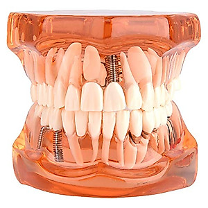Maxmartt Teeth Model, Dental Demonstration Dental Implant Removable Study Model Teeth Teaching Model for Student Teacher, Orange