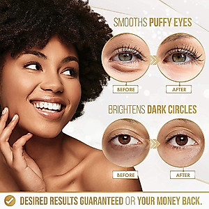 DERMORA Under Eye Mask Patches - 20 Packs - Face Mask Skin Care Products for Puffy Eyes, Dark Circles, Wrinkles and Fine Lines - Cruelty-Free & Vegan Eye Patches - Stocking Stuffers for Women & Men