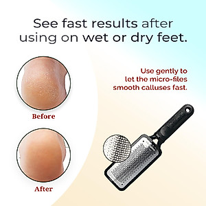 Microplane Colossal Foot File Scraper - The Original Stainless Steel Foot Rasp, Dead Skin/Callus Remover for Feet, Gentle Foot Scrubber, Pedicure Tools for Salon-Quality Foot Care, Black