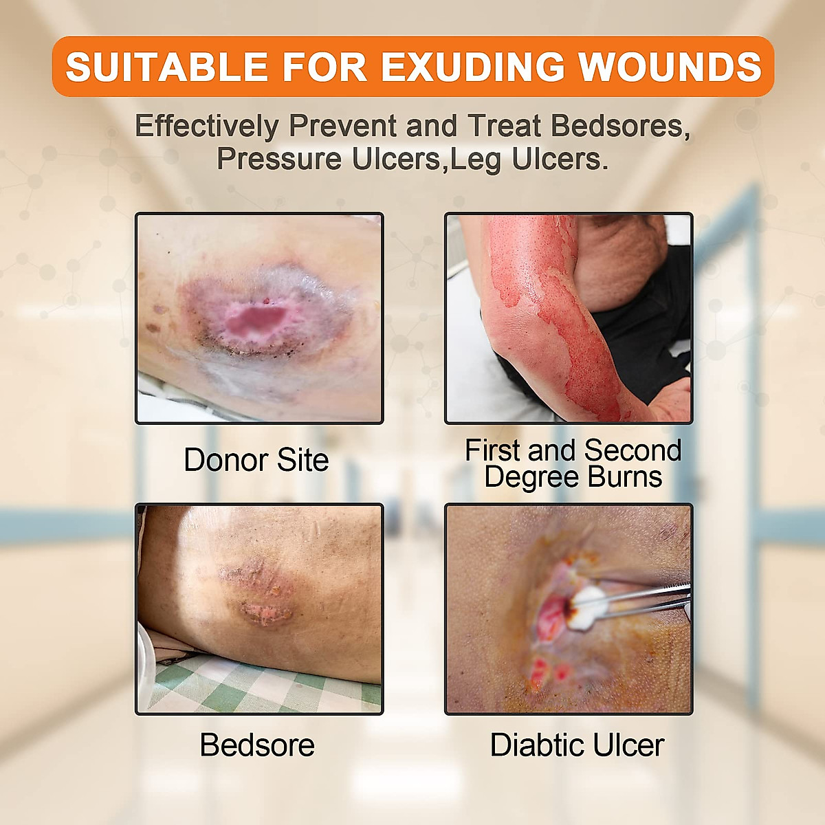 Carbou Silicone Sacrum Foam Dressing, 9''x9''(23cm x23cm) Bordered Silicone Adhesive Sacral Foam Dressing,Silicone Wound Care Products,Box of 5 Dressings