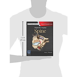 Diagnostic Imaging: Spine