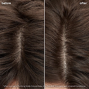 BIOLAGE Scalp Sync Anti-Dandruff Shampoo | Targets Dandruff, Controls The Appearance of Flakes & Relieves Scalp Irritation | Paraben-Free | Vegan