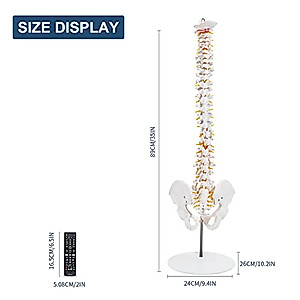 Winyousk Medical Spine Model, Life Size Flexible Anatomical Human Spine Model, Spine Model with Vertebrae, Nerves, Arteries, Lumbar Column and Male Pelvis - Mount on a Stand