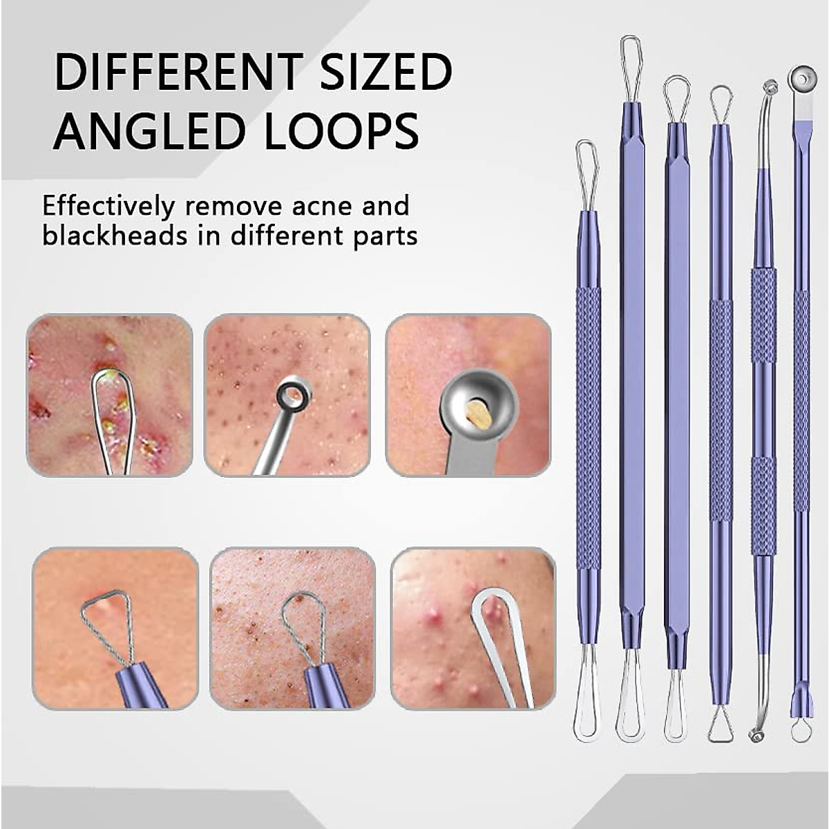 Xesscare Latest Pimple Popper Tool Kit, 16 Pcs Blackhead Remover Tool, Comedone Extractor Acne Removal Kit, Professional Whitehead Tweezers with Metal Case for Facial, Nose and Forehead (Purple)