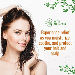 Psoriasis Shampoo for Dry Scalp Care - Anti Dandruff - Gentle Hydrating Shampoo for Itchy Scalp Treatment