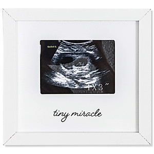 Juvale White Sonogram Keepsake Frame for 4 x 3 Ultrasound Photos (7 x 6.5 Inches)