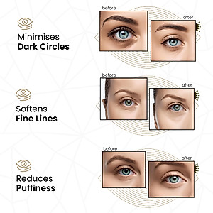 REVITALE Gold under EYE Collagen Gel Mask, Nourishes, Firms & Hydrates, Puffy Eyes & Dark Circles, Hyaluronic Acid (30 Pairs - Jar)