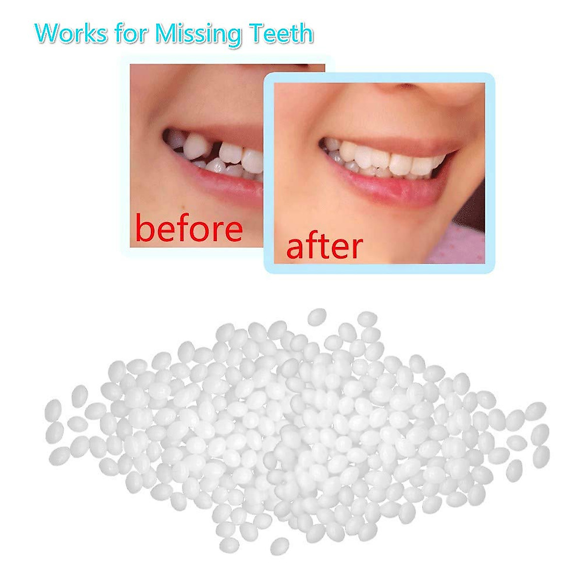 Multi-functional Temporary Tooth Repair Kit Moldable Thermal Fitting Beads for Snap On Instant and Confident Smile Denture Adhesive Fake Teeth Cosmetic Braces Veneer