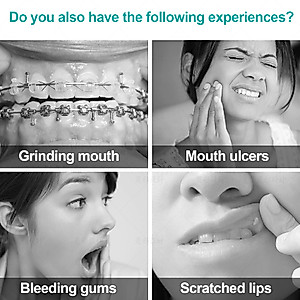 Annhua Orthodontist Braces Wax Ortho Dots 10 Pack for Aligners, Braces Wearer, Brackets, Invisible-lingers, Dental Orthodontic Wax Strips White - Unscented & Flavorless