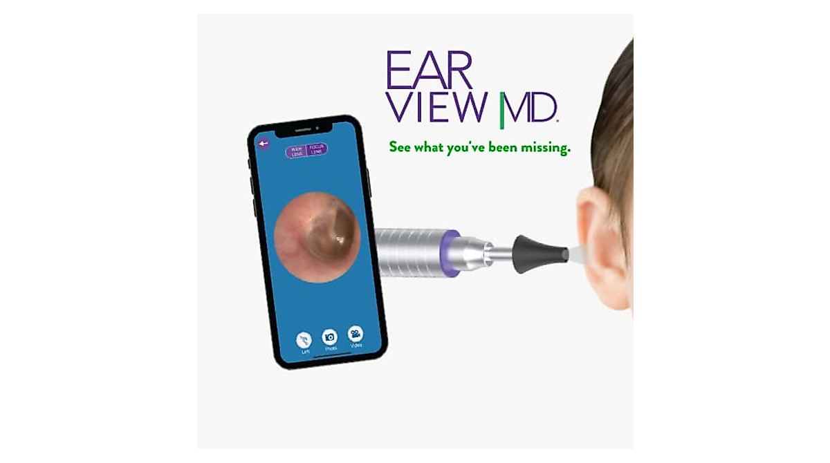Ear View MD: Wi-Fi Ear Camera for Easy Diagnosis
