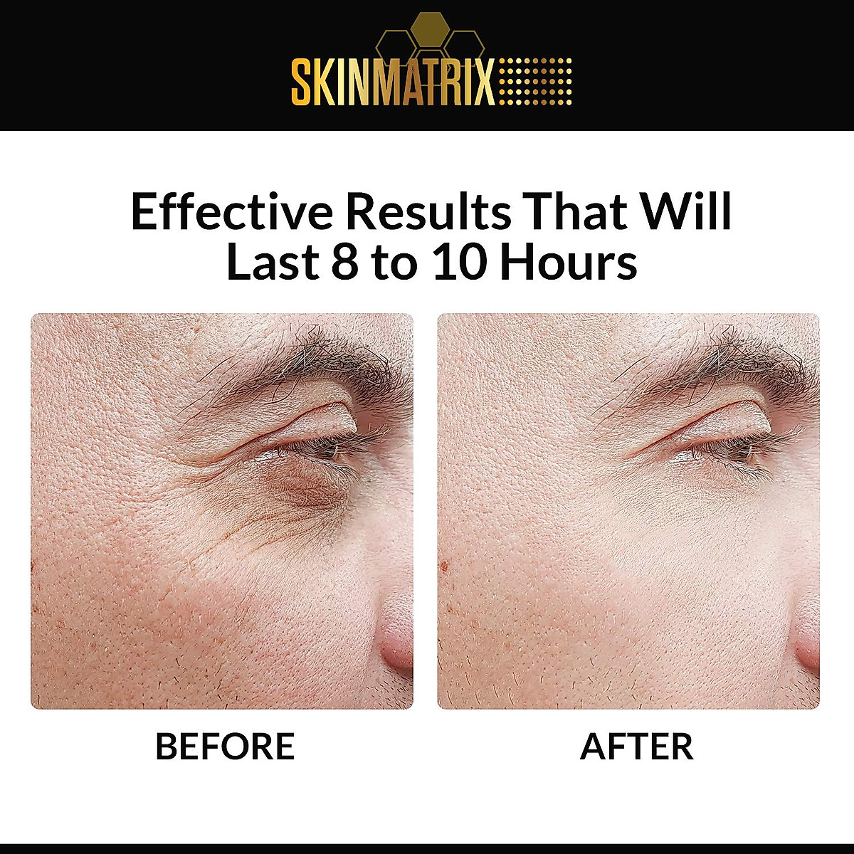 Puffy Eyes Treatment Serum- Anti Aging Under Eye Cream Formula for Puffiness, Dark Circles, Fine Lines, Wrinkles & Under Eye Bags with Hyaluronic Acid & Vitamin C. Instant Results within Minutes.