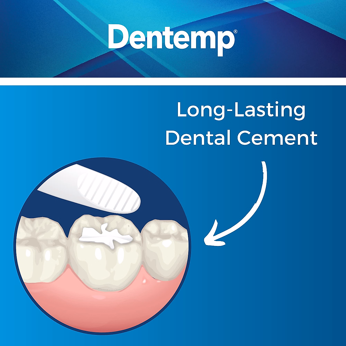 Dentemp Refil-It Filling Repair Material - Temporary Tooth Filling Kit (0.07 Oz) - Tooth Repair Kit for Instant Pain Relief - Long Lasting Tooth Filling