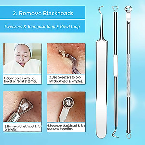 Premium Blackhead Remover, Comedone Blemish Acne Extractor,Popping Pimple Popper Whitehead Removal, Precision Tweezers, Zit Removing, Milia Remove
