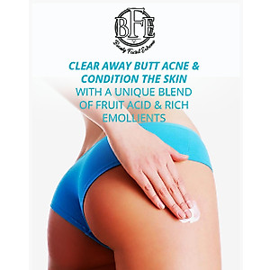 Anti-Acne Buttocks & Thigh Treatment- Clears Away Acne, Pimples, and Ingrown Hairs for the Buttocks and Thigh Area. Prevents Future Breakouts. 6.9 OZ
