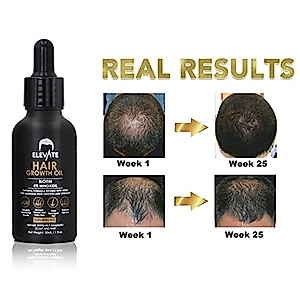 ELEVATE Hair Growth Oil - Biotin Hair Growth Serum & 5% Minoxidil Treatment for Stronger Thicker Longer Hair – Natural Hair Growth Thickening Treatment - Stop Thinning & Hair Loss for Men & Women 1oz