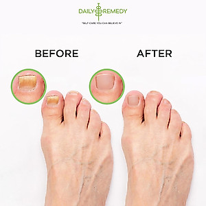 Tea Tree Oil Foot Soak with Epsom Salt - Made in USA - for Toenail Athletes Foot, Stubborn Foot Odor Scent, Softens Calluses & Soothes Sore Tired Feet - 16 Ounces