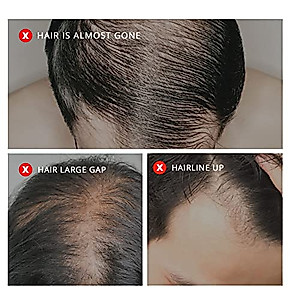 Korean Face Roller Hair Spray Hair Growth Oil Hair Growth Thicker Fuller Healthier Hair Hair Loss And Thinning Women And Men 30ml for Skin Care