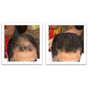 Caboki Hair Loss Concealer, 90-day supply, Dark Brown