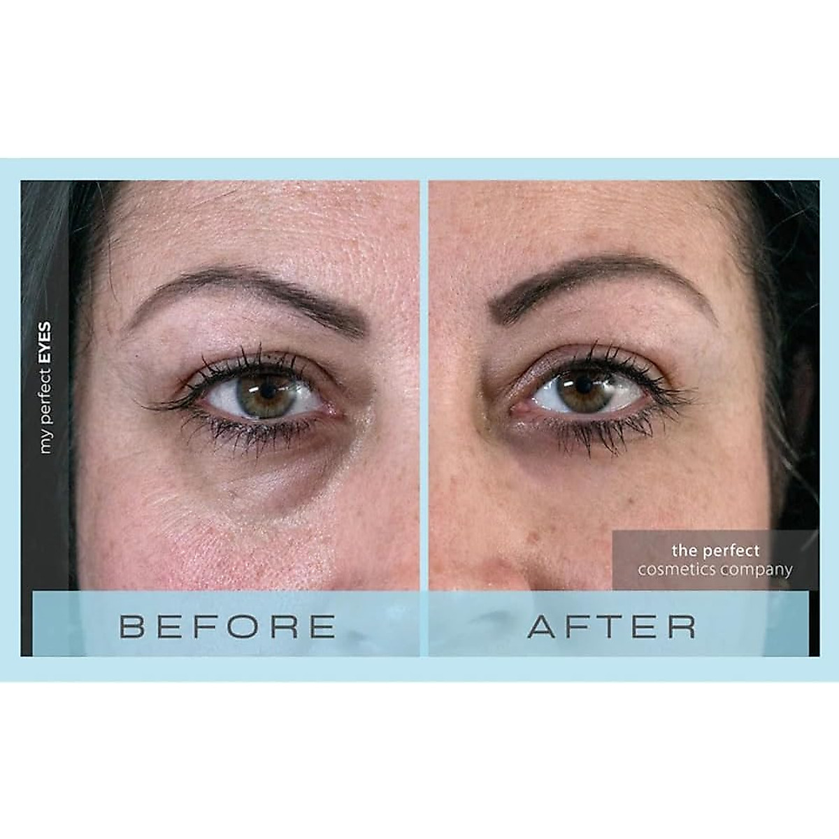 My Perfect Eyes 10ml, 100 Applications, Penny Lane, Instant Results, Clinically Proven, Anti-Ageing Serum UK Original Formula, Science-Backed Anti-Wrinkle Serum. As Seen on TV.