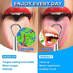6PCS Metal Tongue Scraper, Preminum Tongue Clearners for Adults & Kids, Medical Grade 100% Stainless Steel Tounge Brushes for Oral Healthy Care, Bad Breath Treatment, Easy to Use Tongue Cleaning Tools