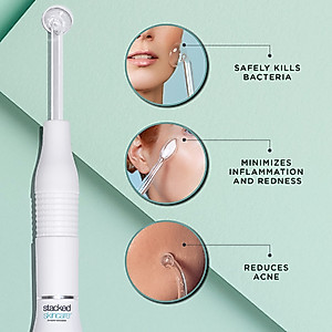 StackedSkincare High Frequency Wand for Acne, Face Tool to Clear Pores and Reduce Redness, Includes Gas Electrodes
