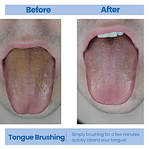 Tongue Cleaner, Tongue Brush, Tongue Scraper for Fresh Breath, Tongue Scraper for Adults | Tongue Scraper for Kid, Tongue Scrapers for Bad Breath Treatment (1 Pack (Brush))