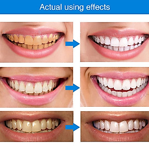 3Pcs Teeth Whitening Pen,Teeth Whitening Essence, Teeth Whitening Gel,Teeth Stain Remover to Whiten Teeth,Intensive Stain Removal Teeth Reduce Yellowing