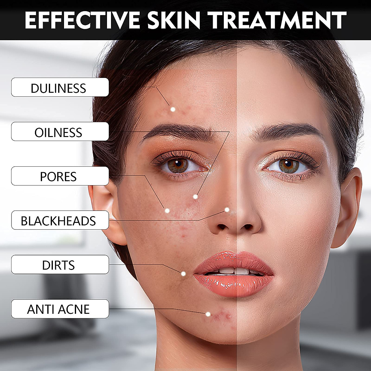 Blackhead Remover Mask Kit 4-in-1 Peel Off Charcoal Face Mask with Vitamin C Serum Blackheads Extractor Tools, and Silicon Brush, Purifying Deep Cleansing Blackheads Acne Mask for Women and Men, 100 g