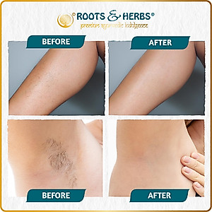 Neem & Fennel Hair Removal Mask - Bikini Hair Removal for Women’s & Men’s Legs, Underarm, & Chest,- Depilatory Powder Body Hair Remover with Ayurvedic Herbs for All Skin Types - Roots & Herbs, 2.47oz