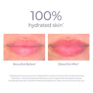 DERMA E Ultra Hydrating Lip Plumping Treatment – Advanced Lip Plumper for Enhanced Fullness and Natural Color – Lip Moisturizer with Hyaluronic Acid, Cinnamon and Jojoba Oil, 0.34 Fl Oz