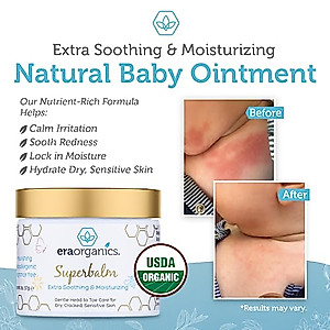 Era Organics Healing Ointment for Babies - USDA Certified Organic Natural Gentle Moisturizer for Sensitive Skin Prone To Baby Eczema, Cradle Cap (Infant Seborrheic Dermatitis), Rashes, Hives & More