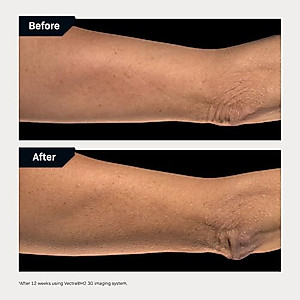 Revision Skincare BodiFirm™, Contouring Body Lotion, Anti Aging and Moisturizing for Tightening Saggy or Crepey Skin, 3.8 oz