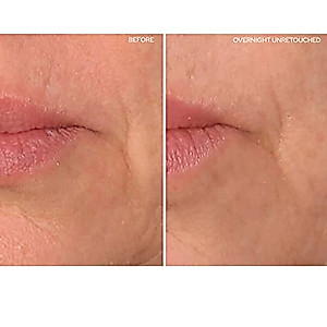 SiO Beauty Super LipLift - Smile & Lip Anti-Wrinkle Patches 4 Week Supply - Overnight Smoothing Silicone Patches For Lip & Smile Wrinkles And Fine Lines