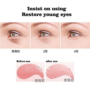 Vnvneye Under Eye Mask, Tomato Vc Gel Eye Mask, Eye Patches for Puffy Eyes,lycopene Dark Circles Under Eye Treatment for Women & Men 30 Pairs Under Eye Gel Pads