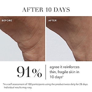 Algenist GENIUS Ultimate Face Cream - Restoring Collagen Cream to Smooth + Help Improve Skin's Radiance - Formulated with Patented Alguronic Acid and Microalgae Oil (2oz)