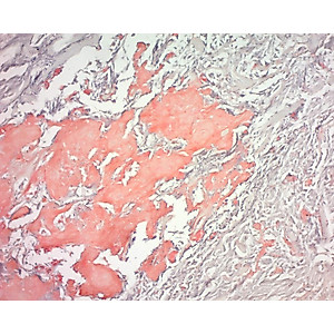 Amyloid Stain Pack (Congo Red), 500ml