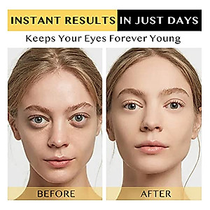 Under Eye Patches (14 Pairs) Under Eye Mask Skincare for Adults Dry Eyes,Eye Masks for Dark Circles and Puffiness,Eye Patch