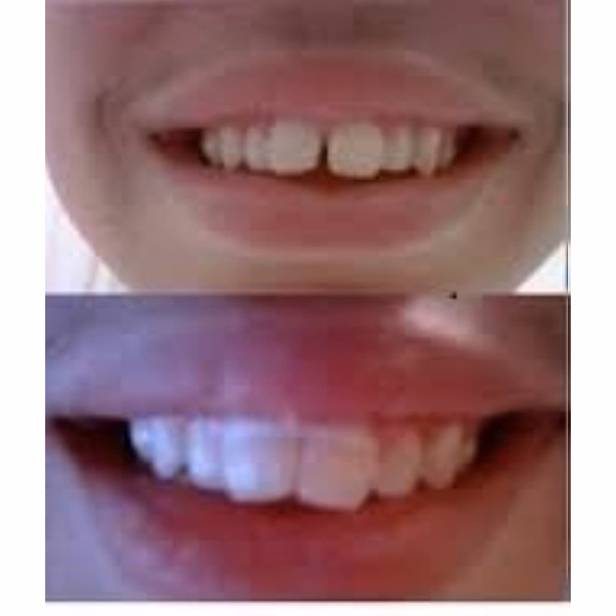 3/16 Inch Orthodontic Elastic Rubber Bands, 100 bands per pack, Natural, Heavy 4.5 Ounces Orthodontic Gap Teeth Bands by AdentalZ