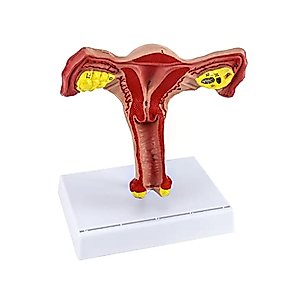 QWORK Human Female Uterus and Ovary Model, Female Genital Organ, Reproductive Organ Model, Uterine Medical Teaching Anatomical Gynecology Uterus and Ovary Model, Human Anatomy Replica