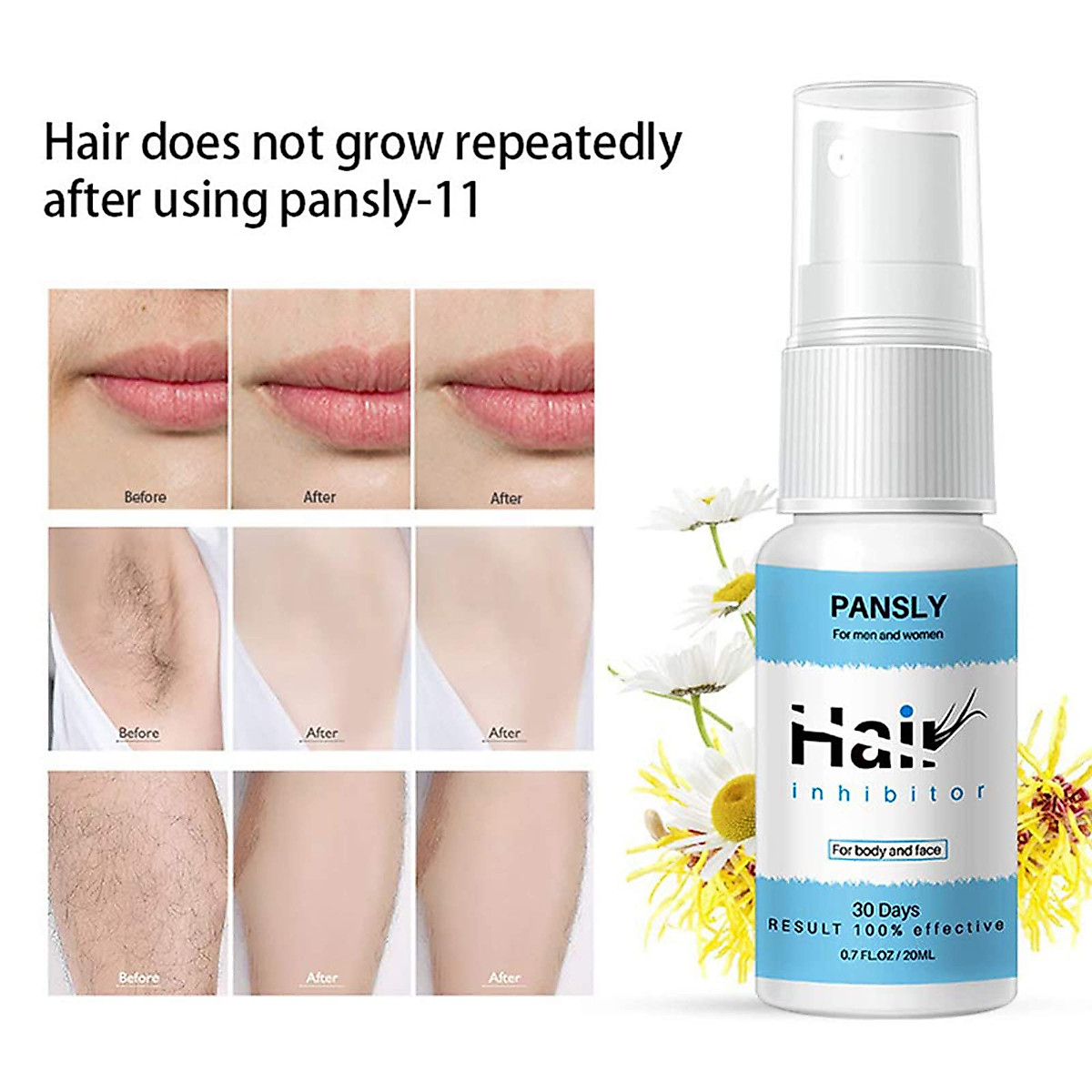 Hair Growth Inhibitor Spray - Permanent Hair Removal for Underarm, Arm, Leg, Bikini Areas for Women and Men, 20ML
