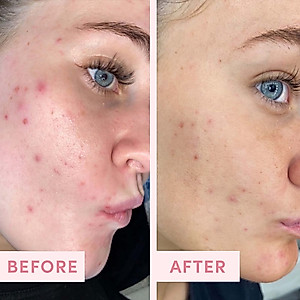 Sand & Sky Flash Perfection Exfoliating Treatment Face Scrub - Face cleanser Australian Pink Clay Moisturizing Facial Exfoliator For Face | With Rosehip, Grapeseed, Olive Oil (3.4 oz)