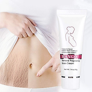 Stretch Mark Cream, Scar Cream Removal Cream Scars Essence Stretch Mark Repair Cream Stretch Scars Remove Acne Cream Stretch Mark Treatment Maternity Repair
