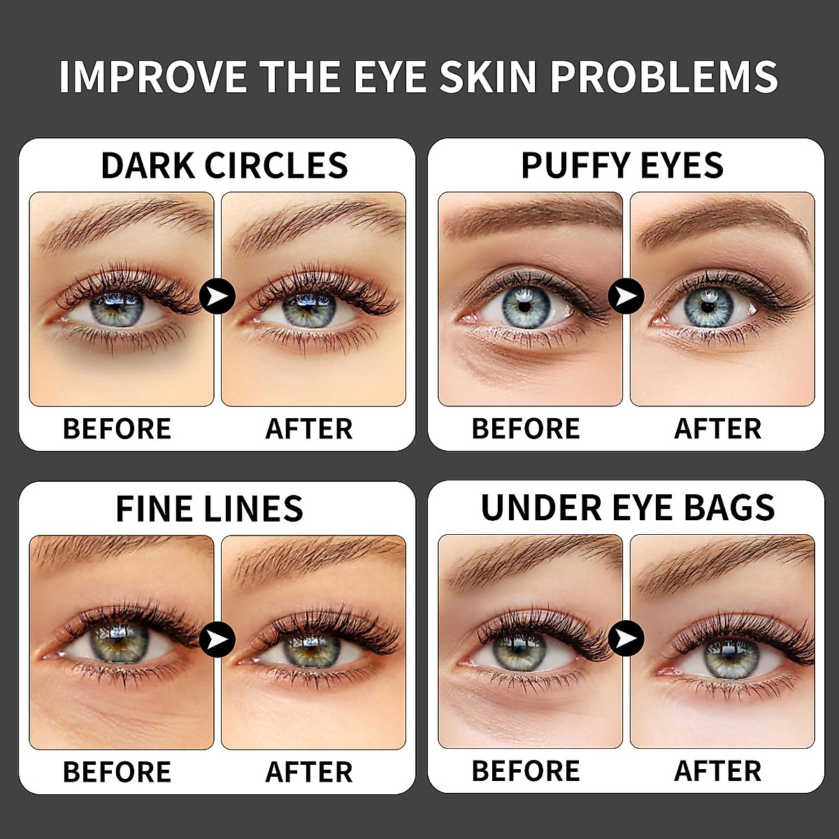 ROUSE Collagen Under Eye Patches with Caffeine Eye Treatment Mask for Dark Circles Eye Fatigue Puffiness Refreshing Revitalizing Skin Care Eye Gel Pads-20 Pairs