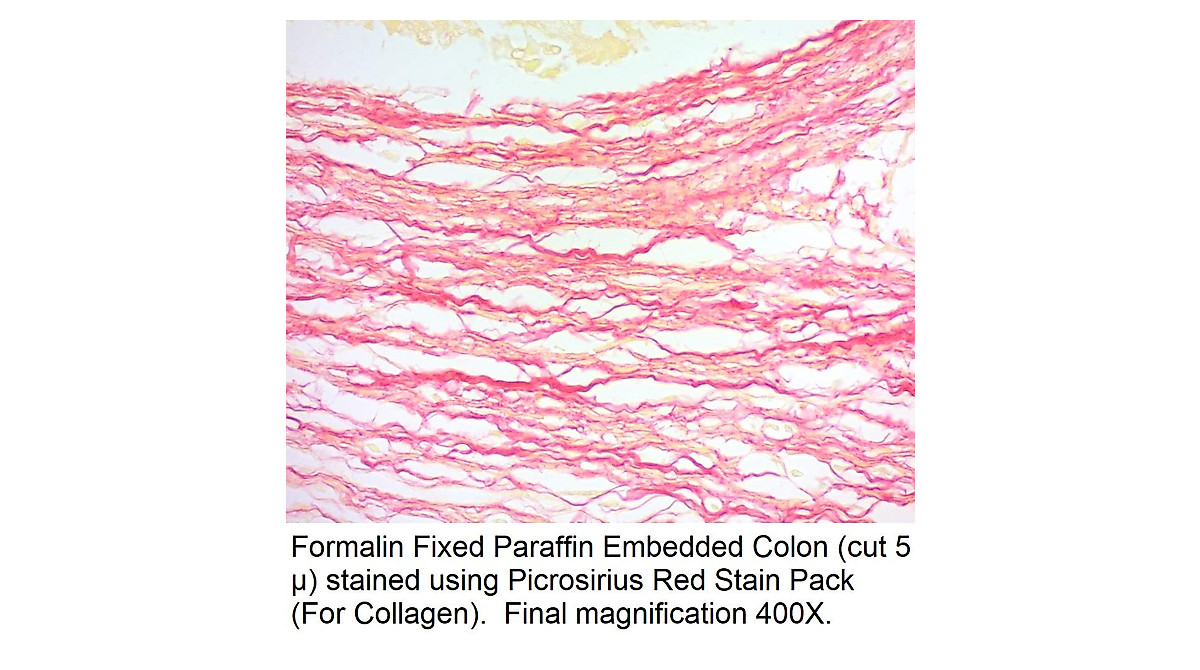 Picrosirius Red Stain Pack for Effective Collagen Staining