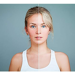 Best Earth Naturals AcneSupplement Formula Blemish Blocker Helps Promote Clear, Radiant, Healthy Skin + Fights Blemishes from Within