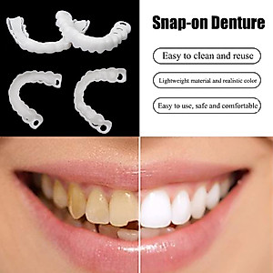 CHJC 2022 New Snap-On Dentures, Veneers Snap in Teeth, Snap in Teeth for Men and Women, Fix Confident Smile, White (CREAM)