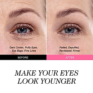 ZealSea 20 Pairs Under Eye Masks for Dark Circles and Puffy Eyes - Hydrating Eye Patches, Gel Eye Patches Eye Bags Treatment for Women - Cling to Eye Moisturizing Lighten Fine Lines