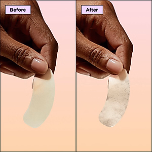 ZitSticka Hydrocolloid Surface Area Pimple Patches for Face - 2 Pack FACE MAP for Large Zit T-Zone Coverage - Absorbs Oil, Unclogs Pores, & Targets Clusters - Zit Patch and Sticker